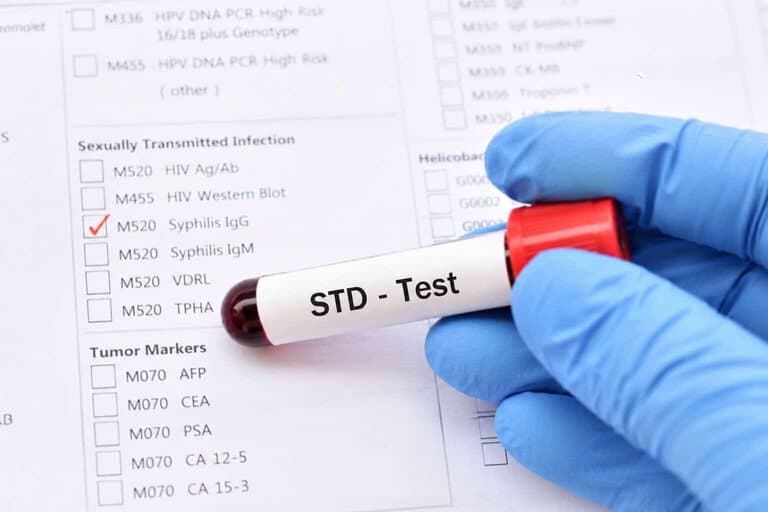 Europe STI Cases Hit Record High as Gonorrhoea Surges - KWETU NEWS