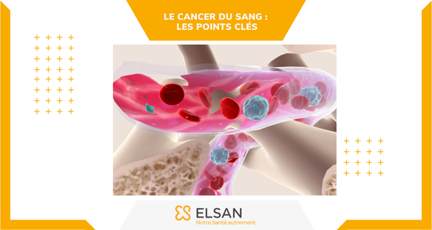 Les cancers du sang : symptômes et traitement