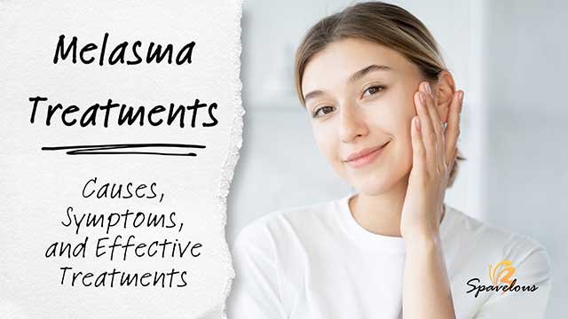 Melasma Treatments: Causes, Symptoms, And Effective Treatments For ...