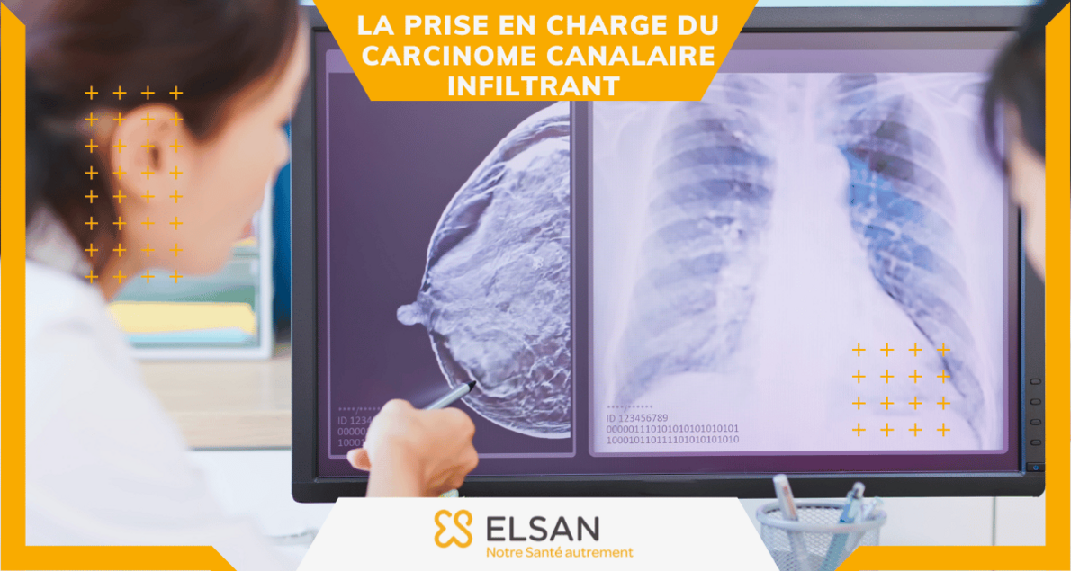 Carcinome Canalaire Infiltrant Diagnostic Et Traitements