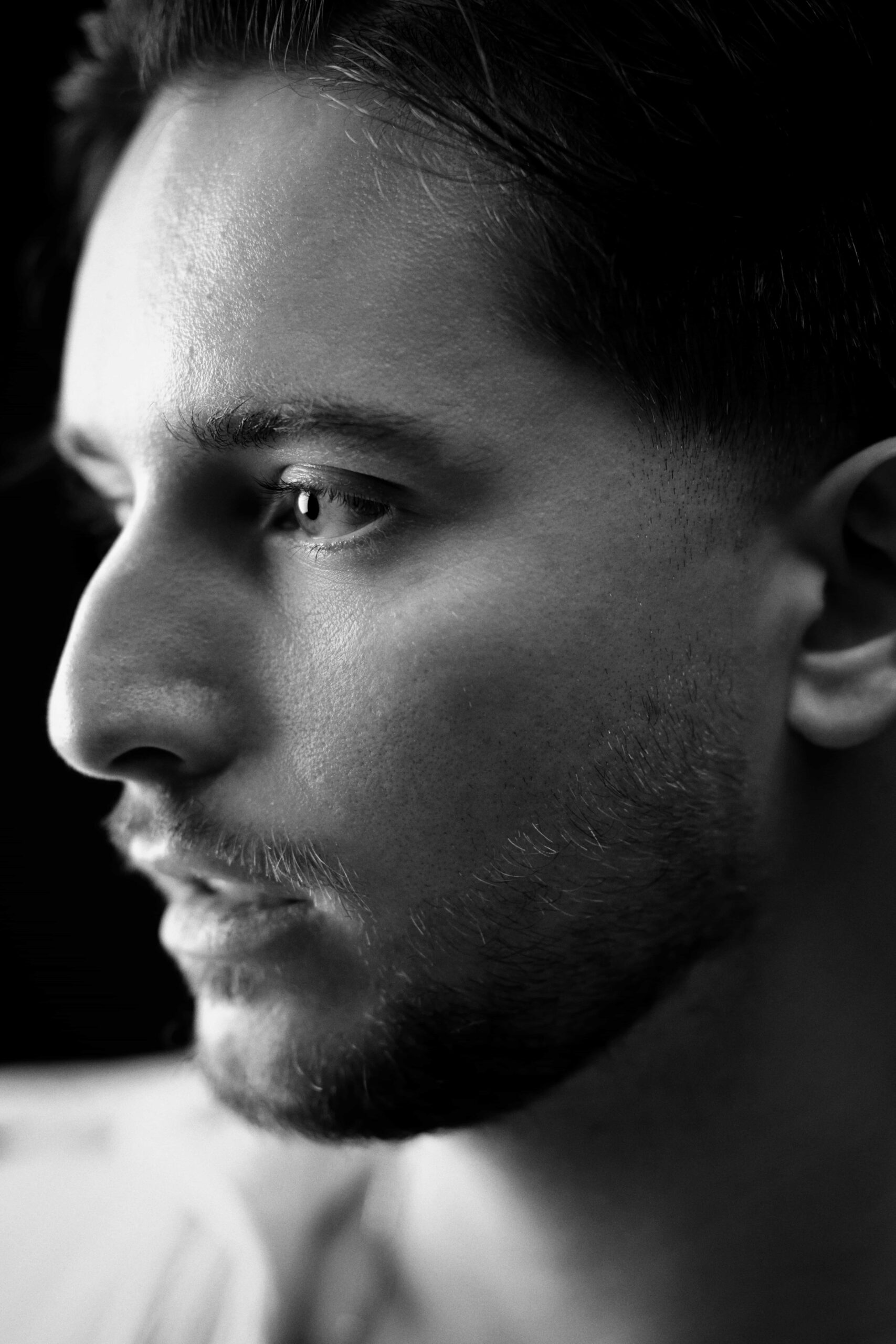 Overbite After Braces? Here’s How to Fix It - Magic Smiles