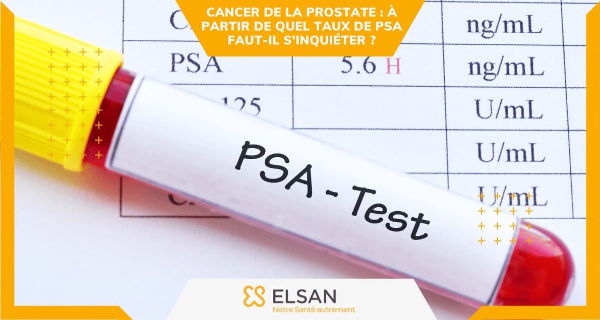 A partir de quel taux de PSA faut-il s'inquiéter(cancer de prostate)