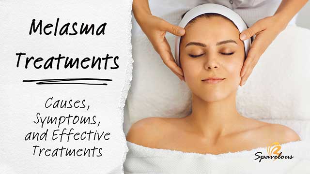 Melasma Treatments: Causes, Symptoms, And Effective Treatments For ...