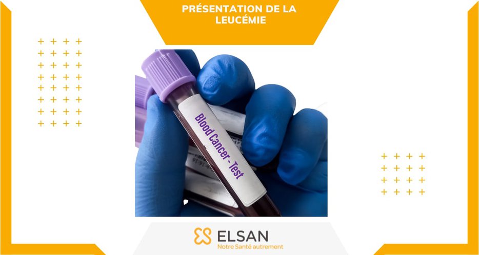 Leucémie: symptômes, traitements et espérance de vie