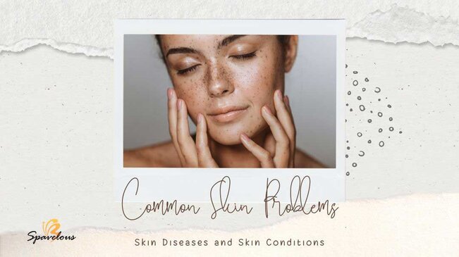 Common Skin Problems: A Closer Look At Skin Diseases And Skin Conditions