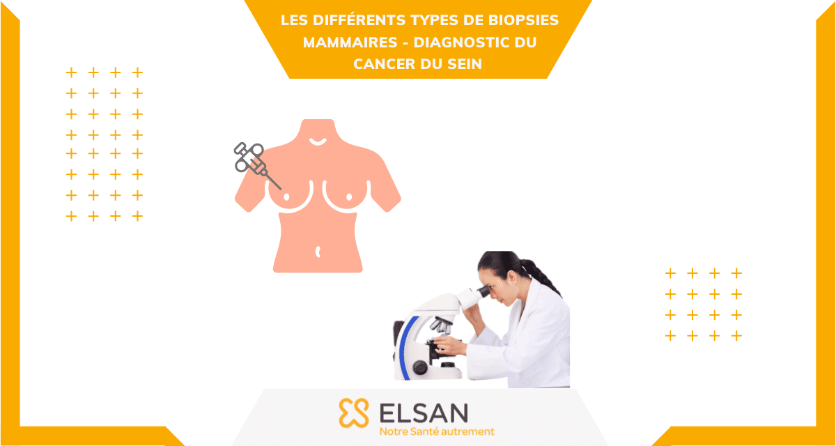 Les Biopsies Mammaires : Modalités et avantages des biopsies du sein