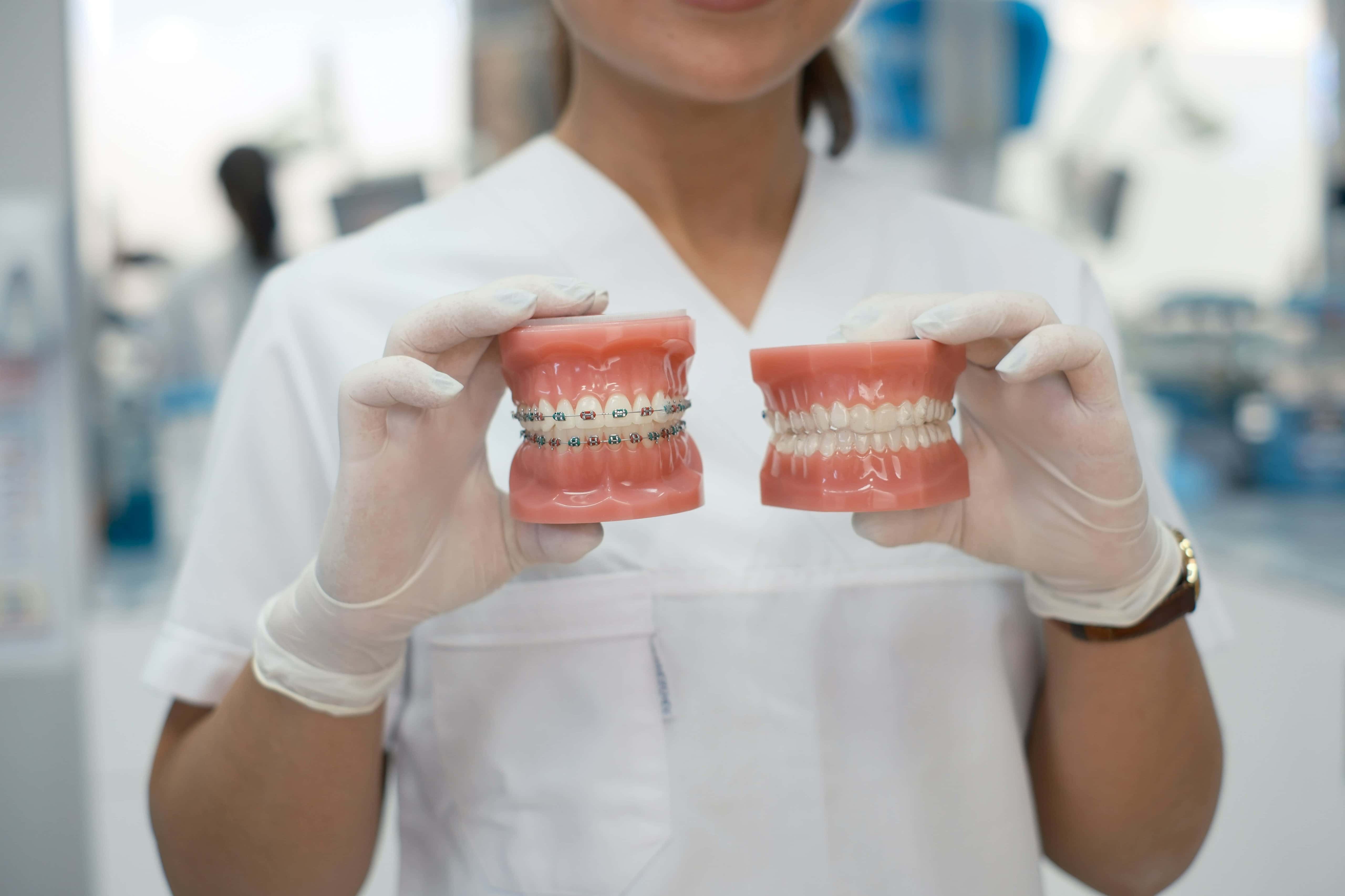 The Stages of Braces: What to Expect - Pendleton Orthodontics